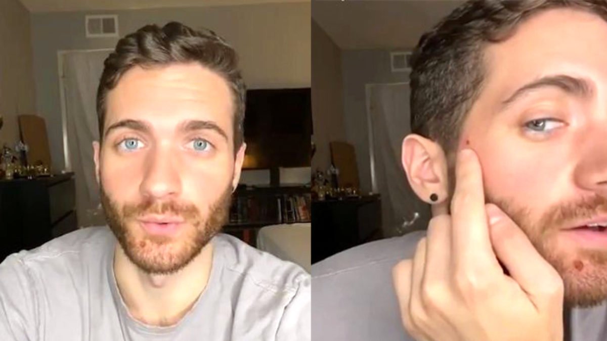 American Actor Matt Ford Goes Public With Monkeypox Infection